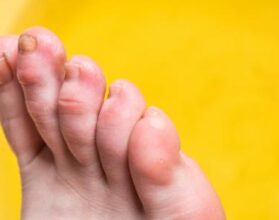 دواعي استعمال كريم ديكسبانثينول Dexpanthenol للحساسية والآثار الجانبية ...