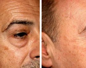 دواعي استعمال كريم ديكسبانثينول Dexpanthenol للحساسية والآثار الجانبية ...